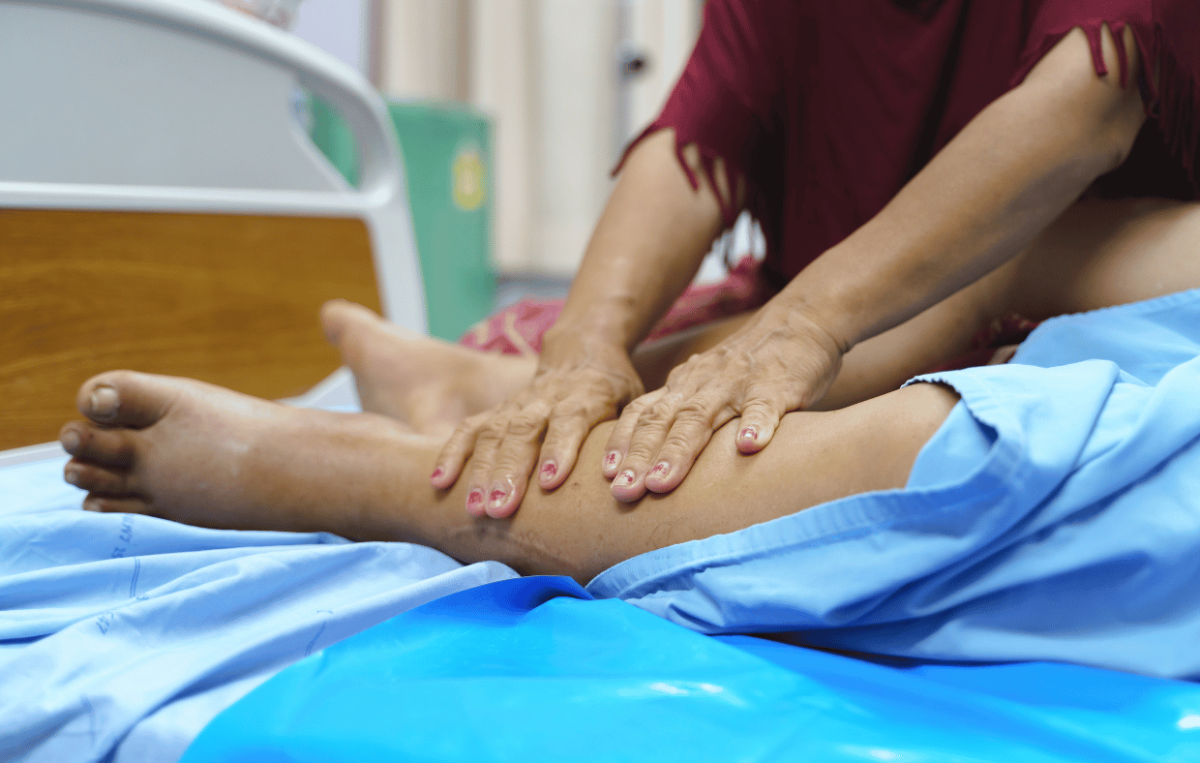 The RAD Diet Food List to Curb Lipedema Swelling - Healthy Premiere